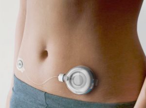 Developing a Variable Dose Insulin Injector Pen Device